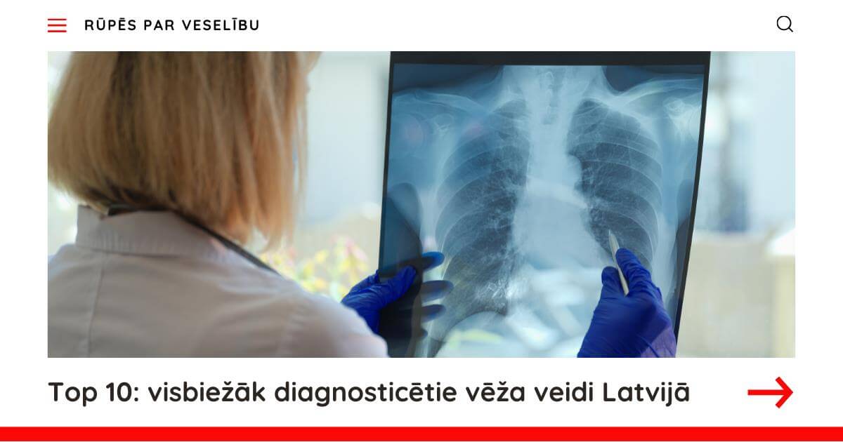 Top 10: visbiežāk diagnosticētie vēža veidi Latvijā