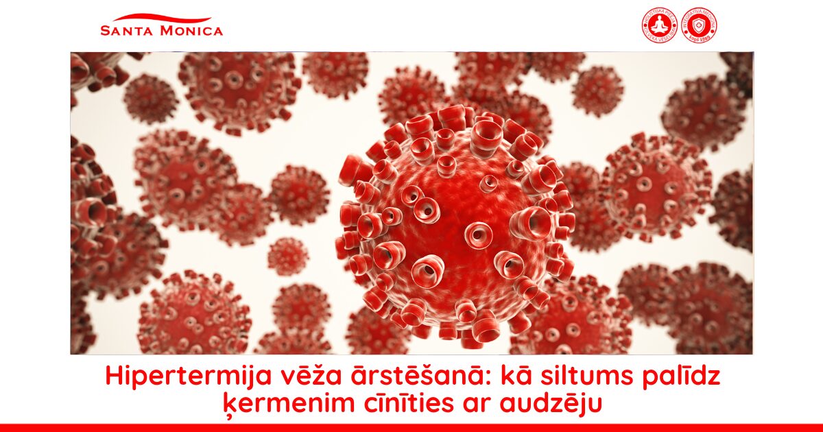 Hipertermija vēža ārstēšanā: kā siltums palīdz cīnīties ar audzēju